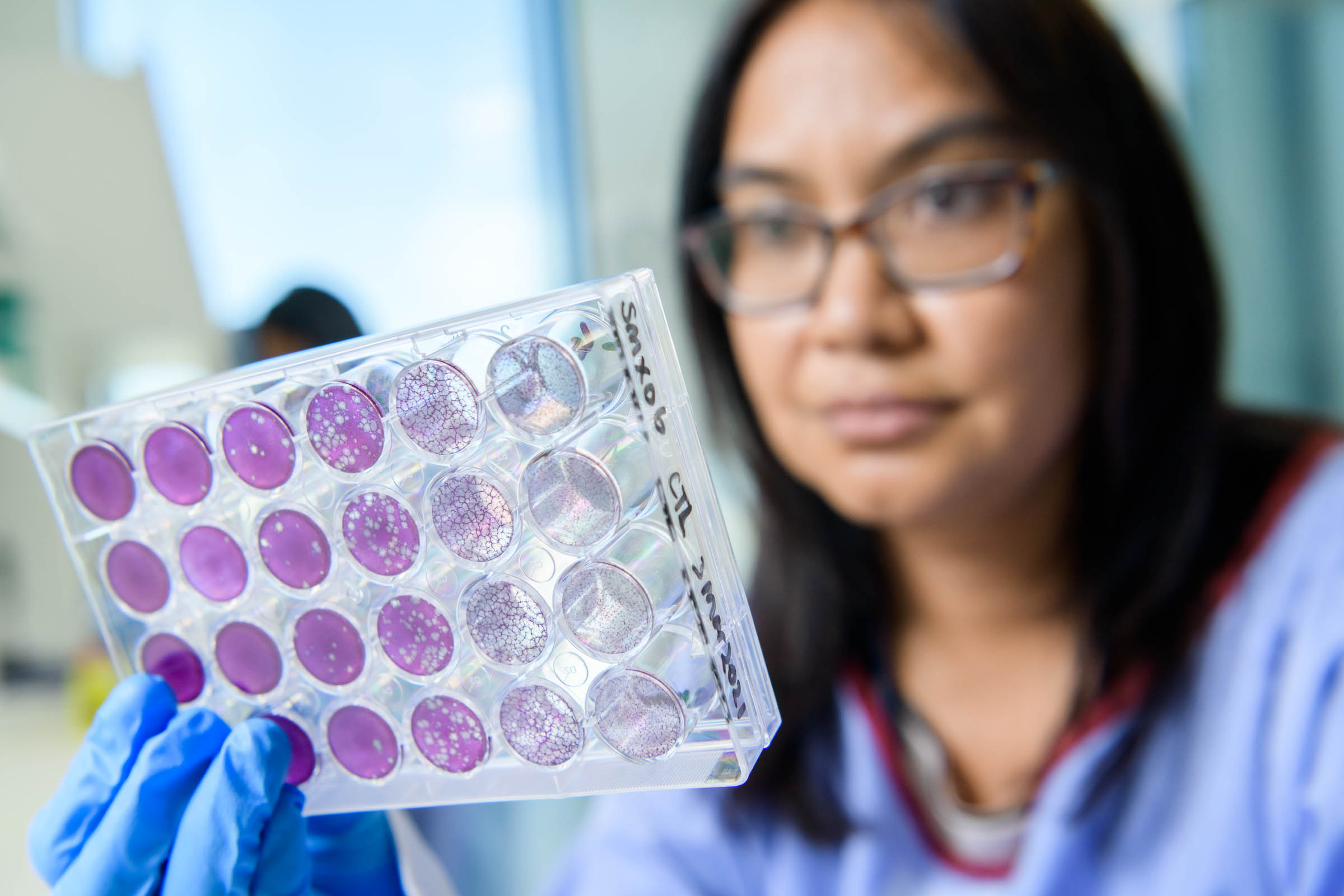 New vaccinia-based COVID-19 vaccine candidate induces robust, durable ...